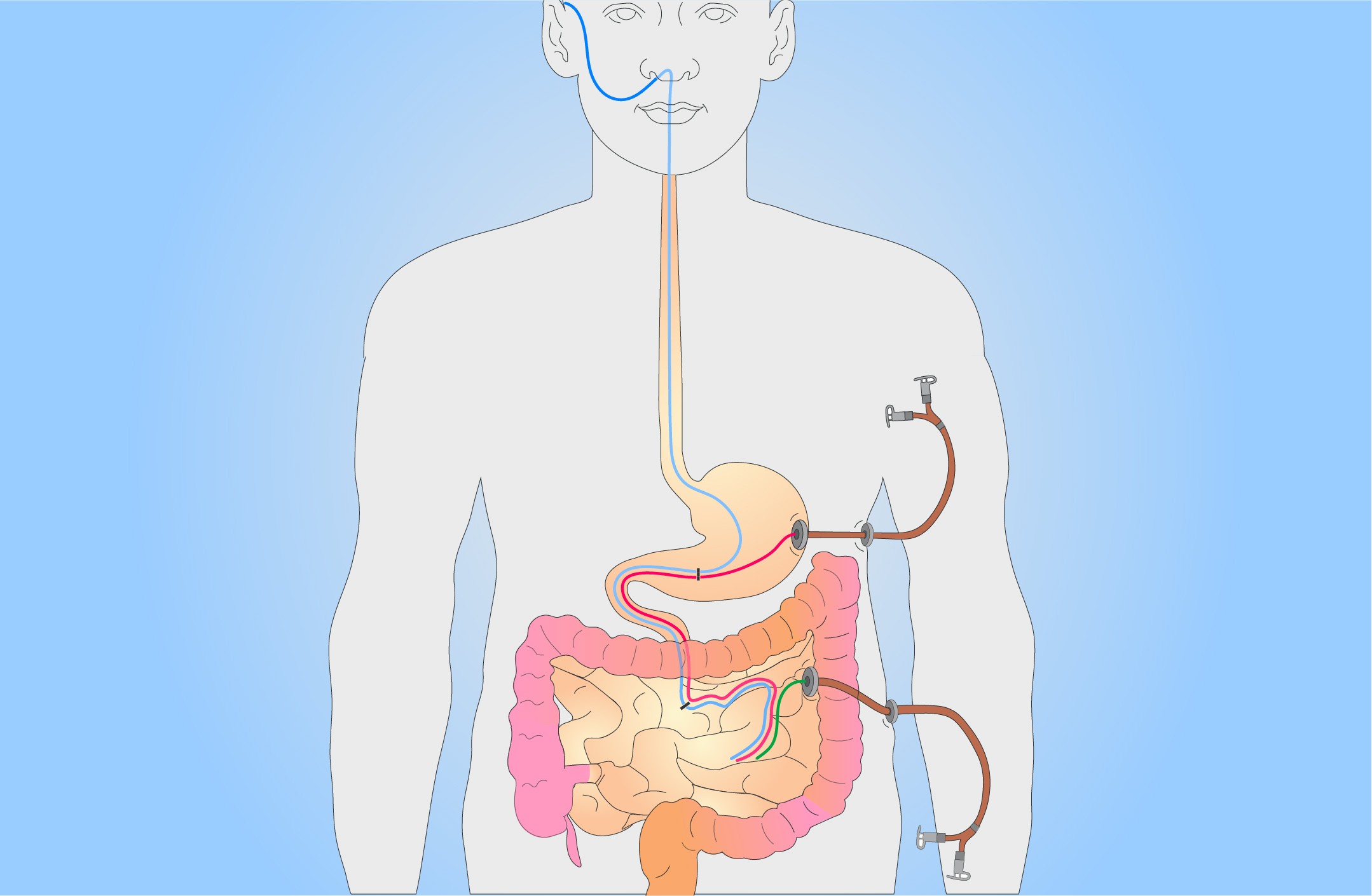 Enteral Nutrition UEG United European Gastroenterology